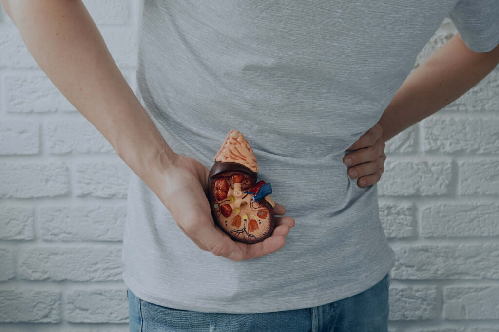 Breaking Down Kidney Stones With Medical Lasers - IML